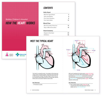 Heart Diagrams & Learning Tools - The Western Canadian Children’s Heart ...